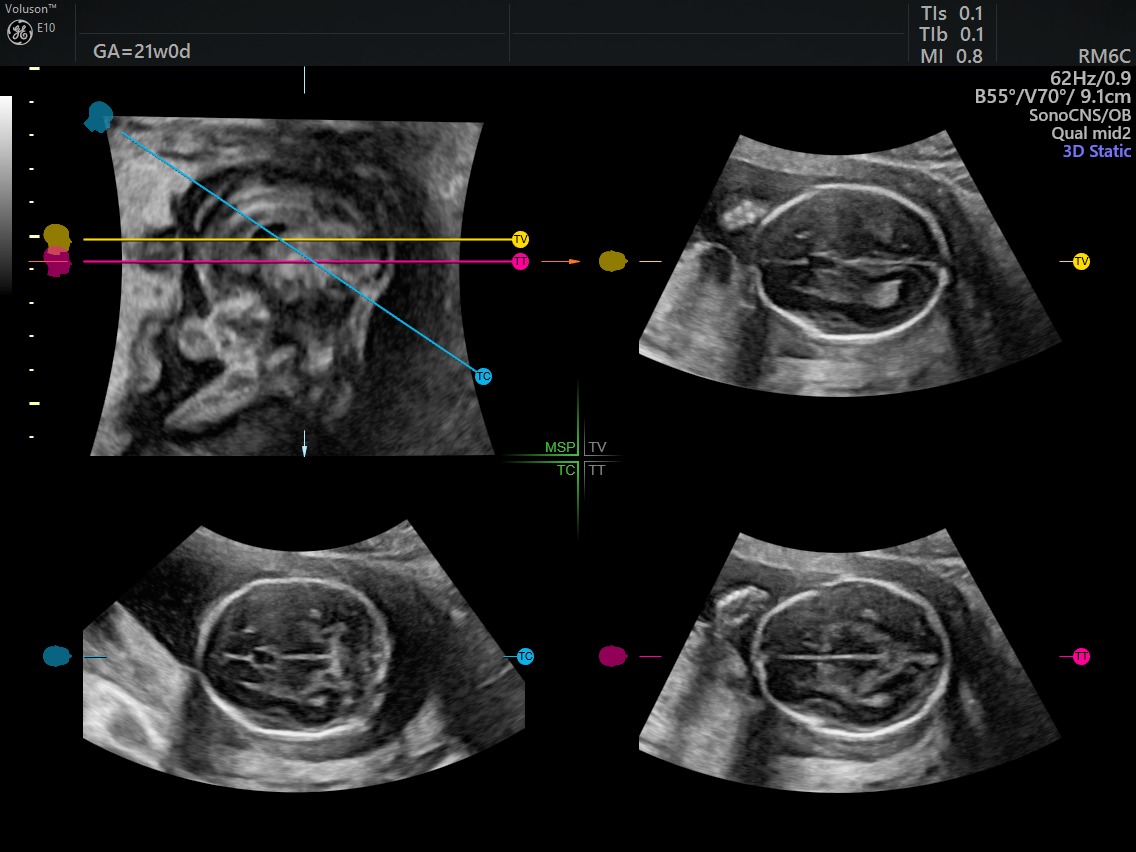 Gynecology Ultrasound Course - Gynaecology Ultrasound Courses ...